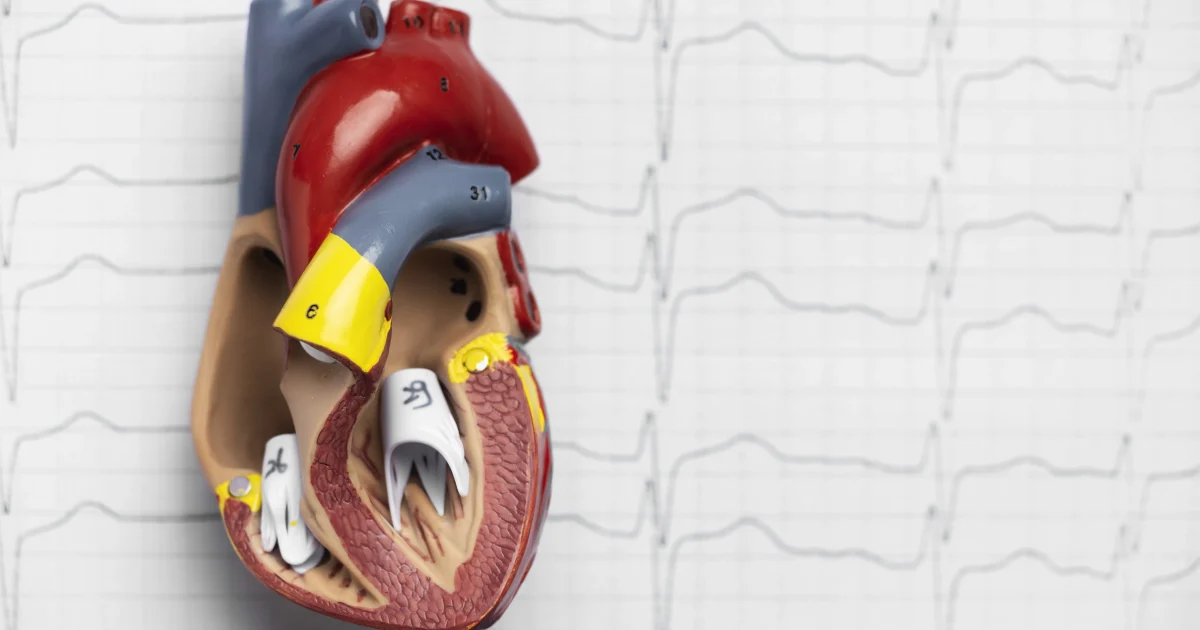 Burying the Lead: Advances and Opportunities in Implantable Cardiac ...